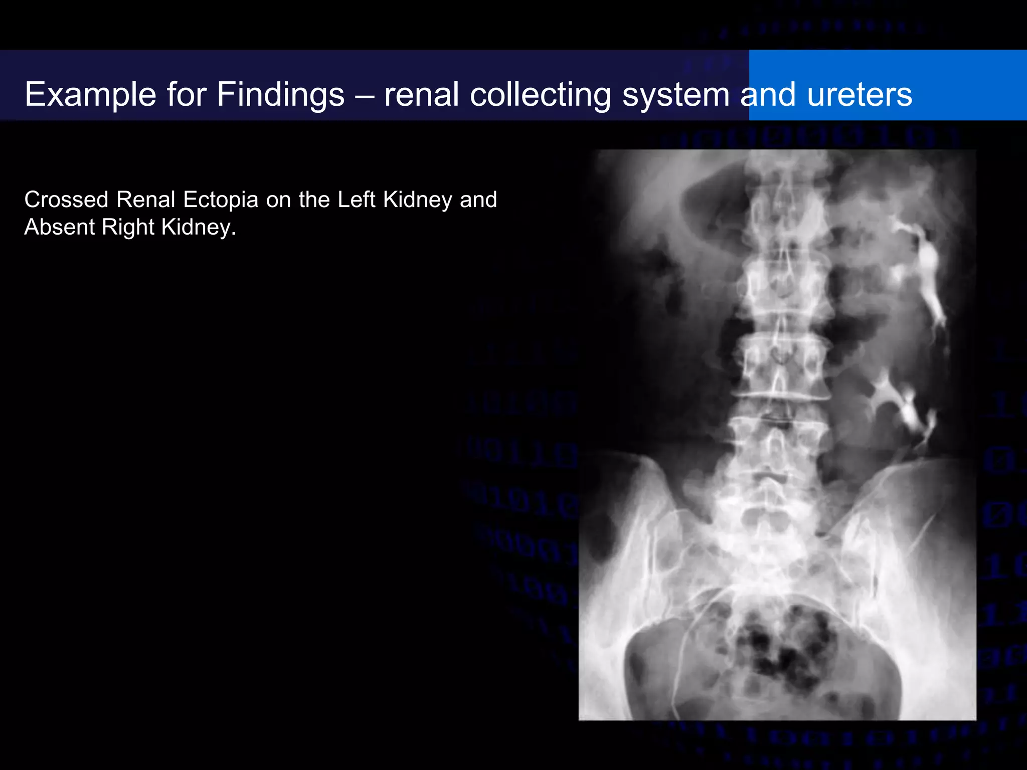 Intravenous urography (IVU) | PDF