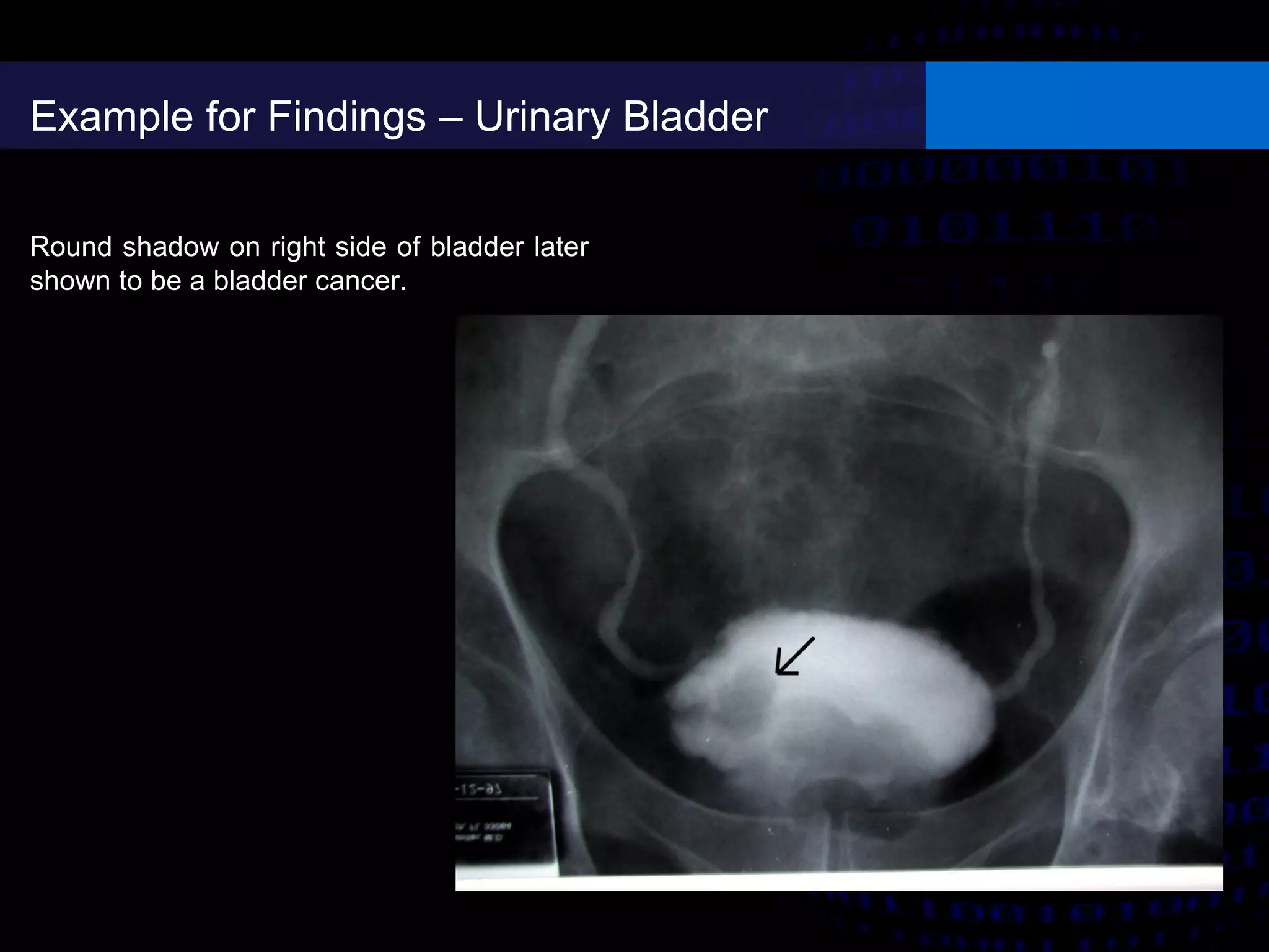 Intravenous urography (IVU) | PDF