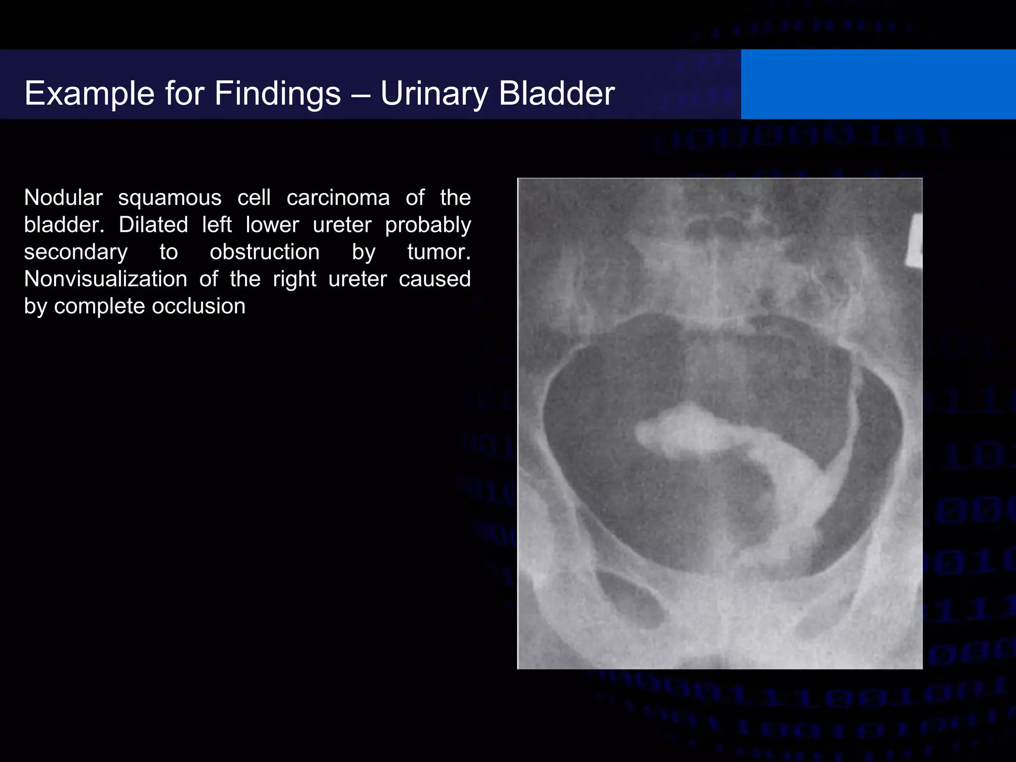 Intravenous urography (IVU) | PDF