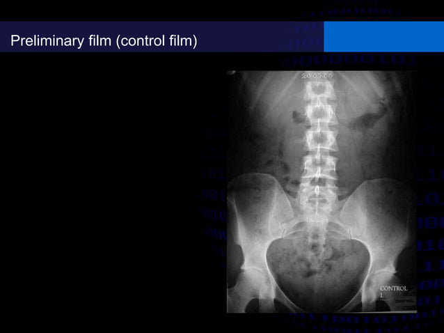 Intravenous urography (IVU) | PDF | Digestive Disorders | Diseases and ...