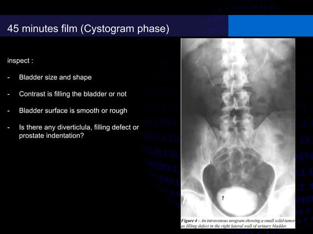 Intravenous urography (IVU) | PDF | Digestive Disorders | Diseases and ...