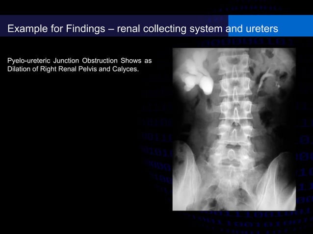 Intravenous urography (IVU)