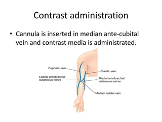 Intravenous Urography (IVU)., radiological procedure | PPTX