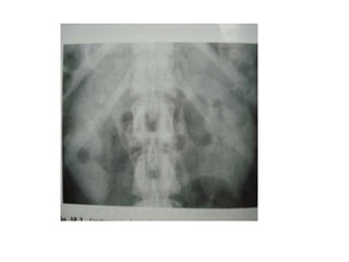 Intravenous Urography (IVU)., radiological procedure | PPTX