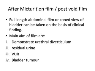 Intravenous Urography (IVU)., radiological procedure | PPTX