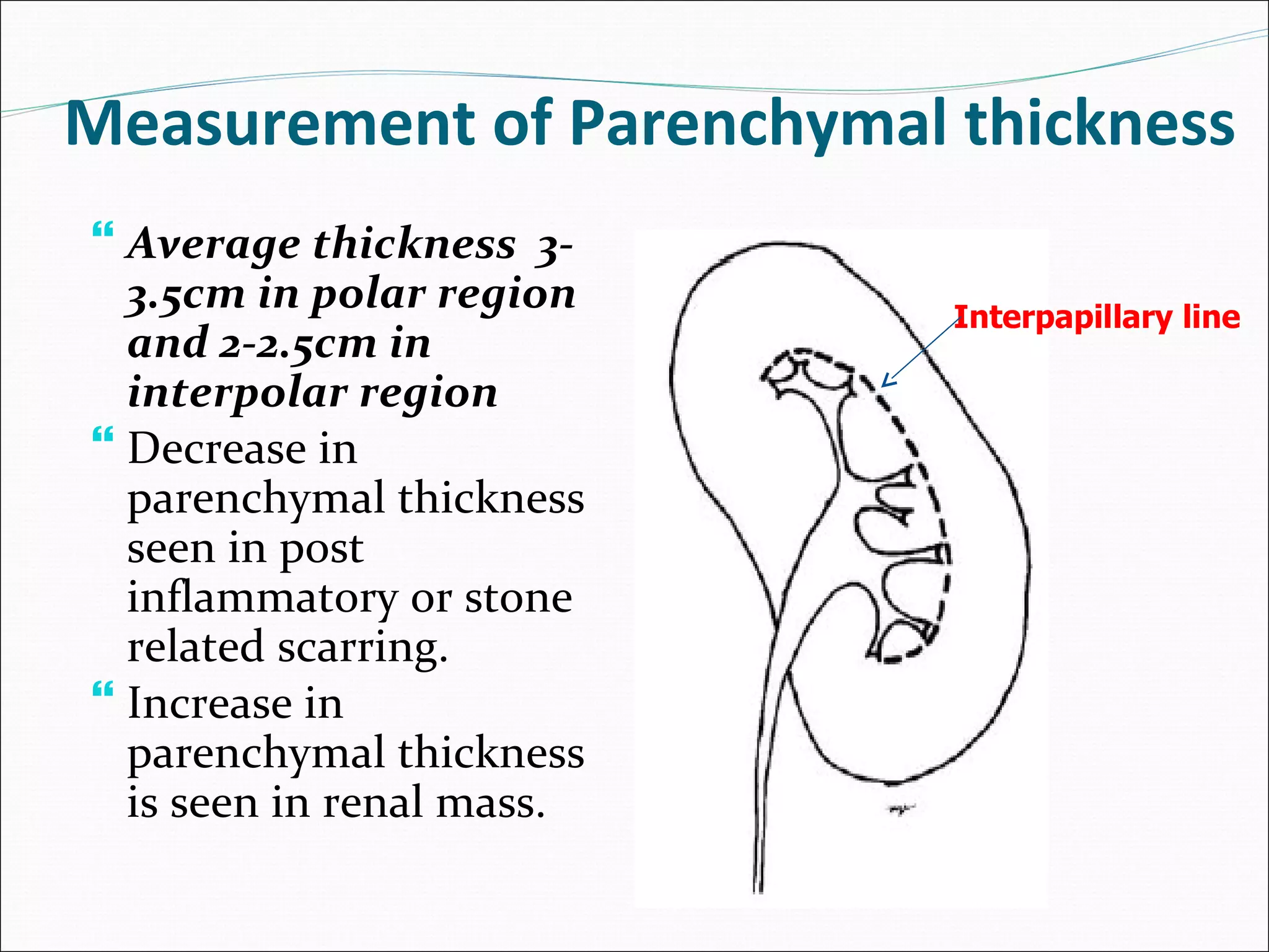 Intravenous urography (IVU) by Dr Bishnu Khatiwada, Conventional IVU ...