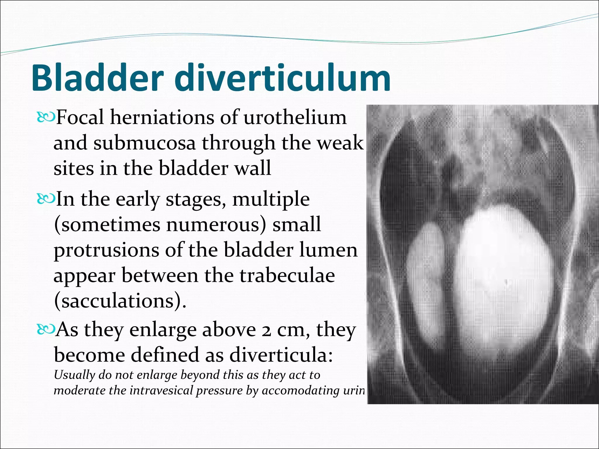 Intravenous urography (IVU) by Dr Bishnu Khatiwada, Conventional IVU ...