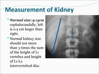 Intravenous urography (IVU) by Dr Bishnu Khatiwada, Conventional IVU ...