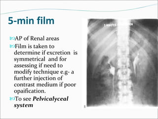 Intravenous urography (IVU) by Dr Bishnu Khatiwada, Conventional IVU ...