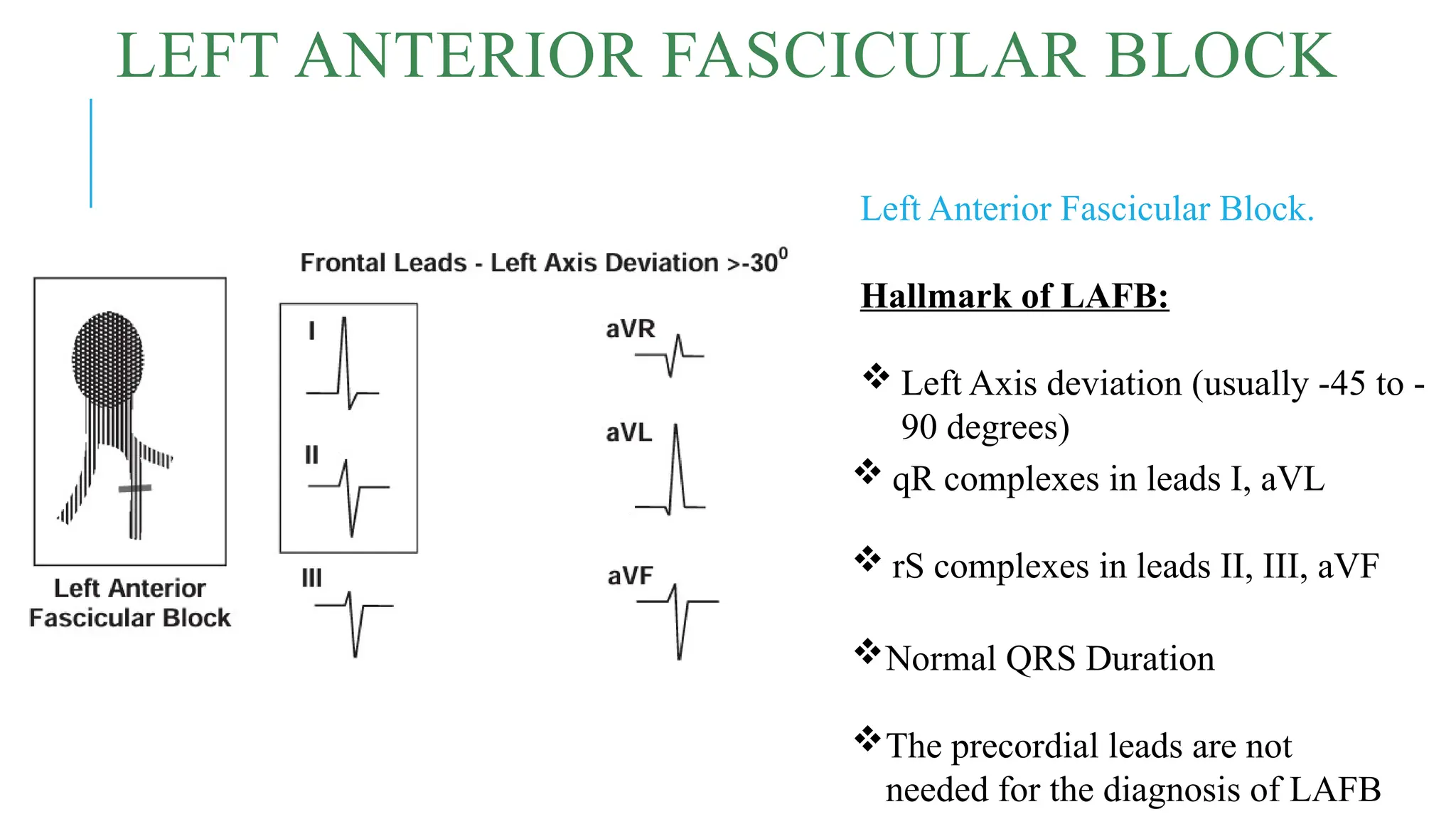 Intraventricular conduction block....... | PPTX