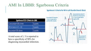 Intraventricular conduction block....... | PPTX