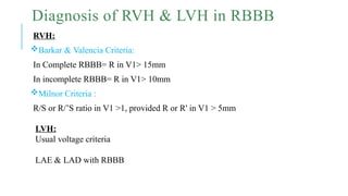 Intraventricular conduction block....... | PPTX