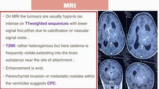 Intraventricular mass (Radiology) of a child {A CASE} | PPT