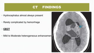 Intraventricular mass (Radiology) of a child {A CASE} | PPTX