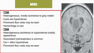 Intraventricular mass (Radiology) of a child {A CASE} | PPT