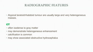 Intraventricular mass (Radiology) of a child {A CASE} | PPT