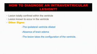 Intraventricular mass (Radiology) of a child {A CASE} | PPT