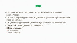 Intraventricular mass (Radiology) of a child {A CASE} | PPT