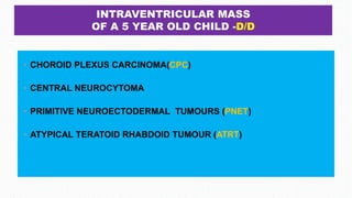 Intraventricular mass (Radiology) of a child {A CASE} | PPT