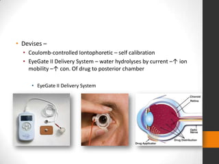 Intravitreal antibiotics new | PPT
