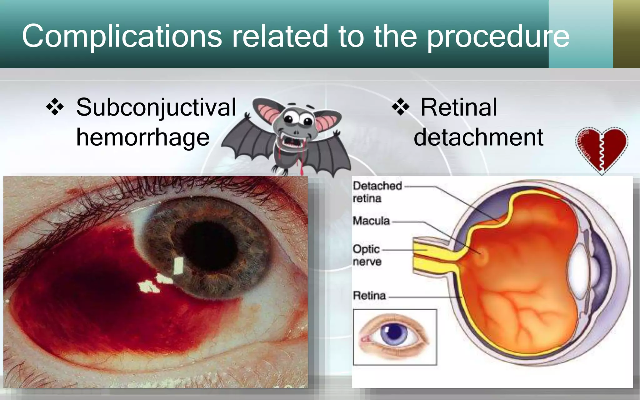 Intravitreal drugs in uveitis | PPT