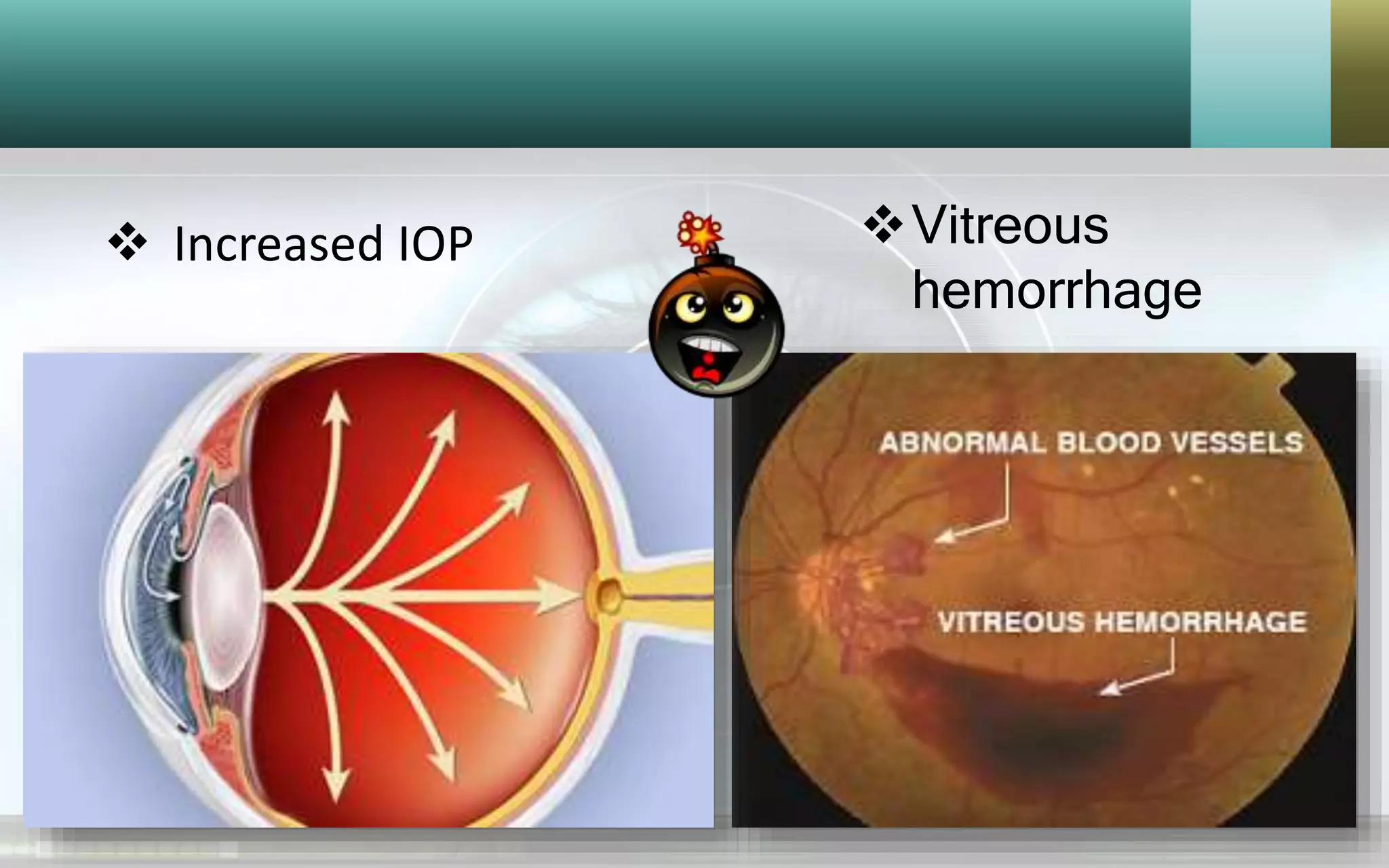 Intravitreal drugs in uveitis | PPT