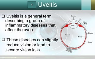 Intravitreal drugs in uveitis | PPT
