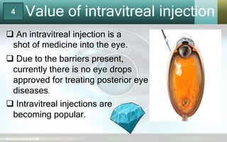 Intravitreal drugs in uveitis | PPTX