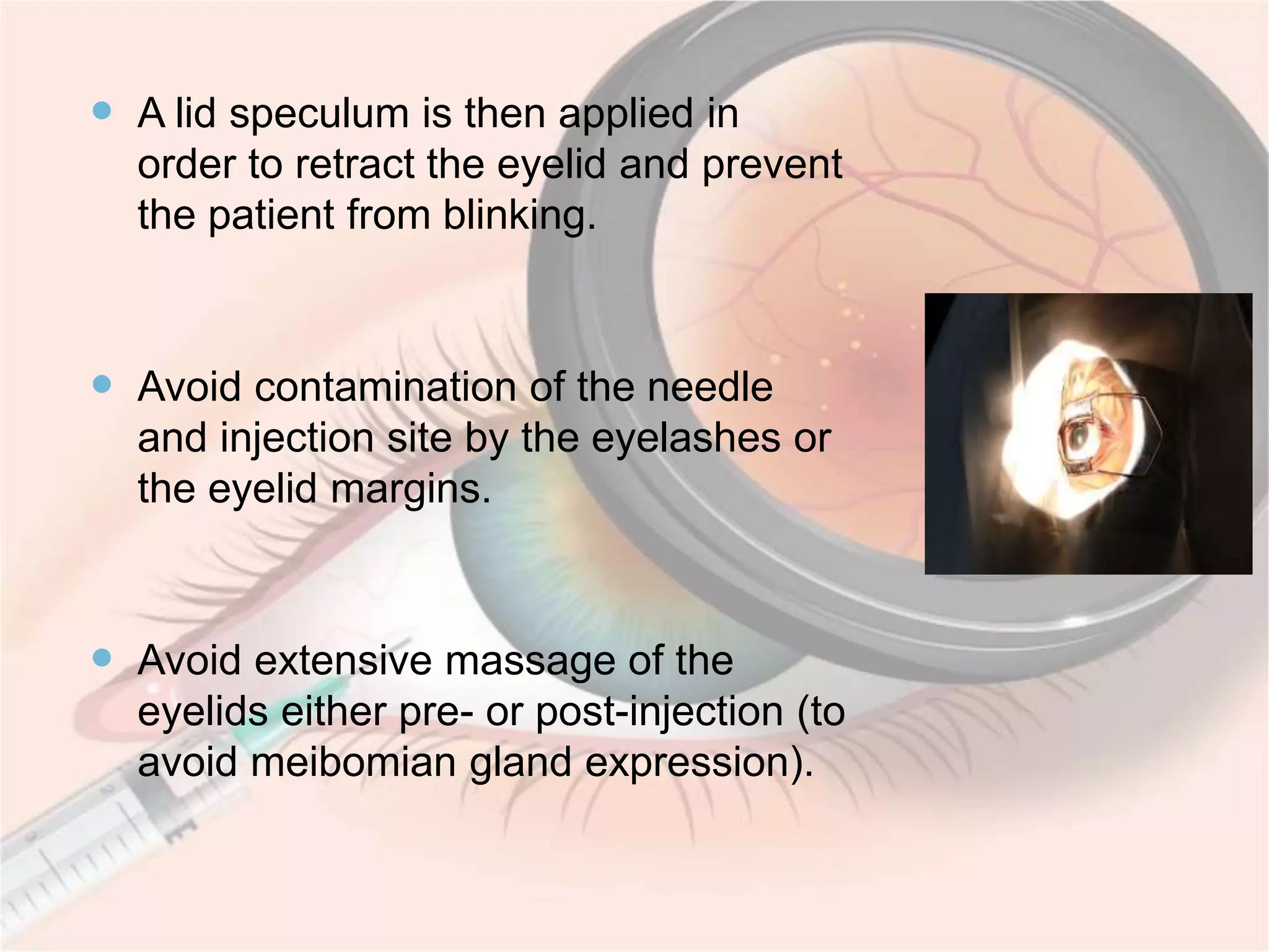 Intravitreal injection | PPTX