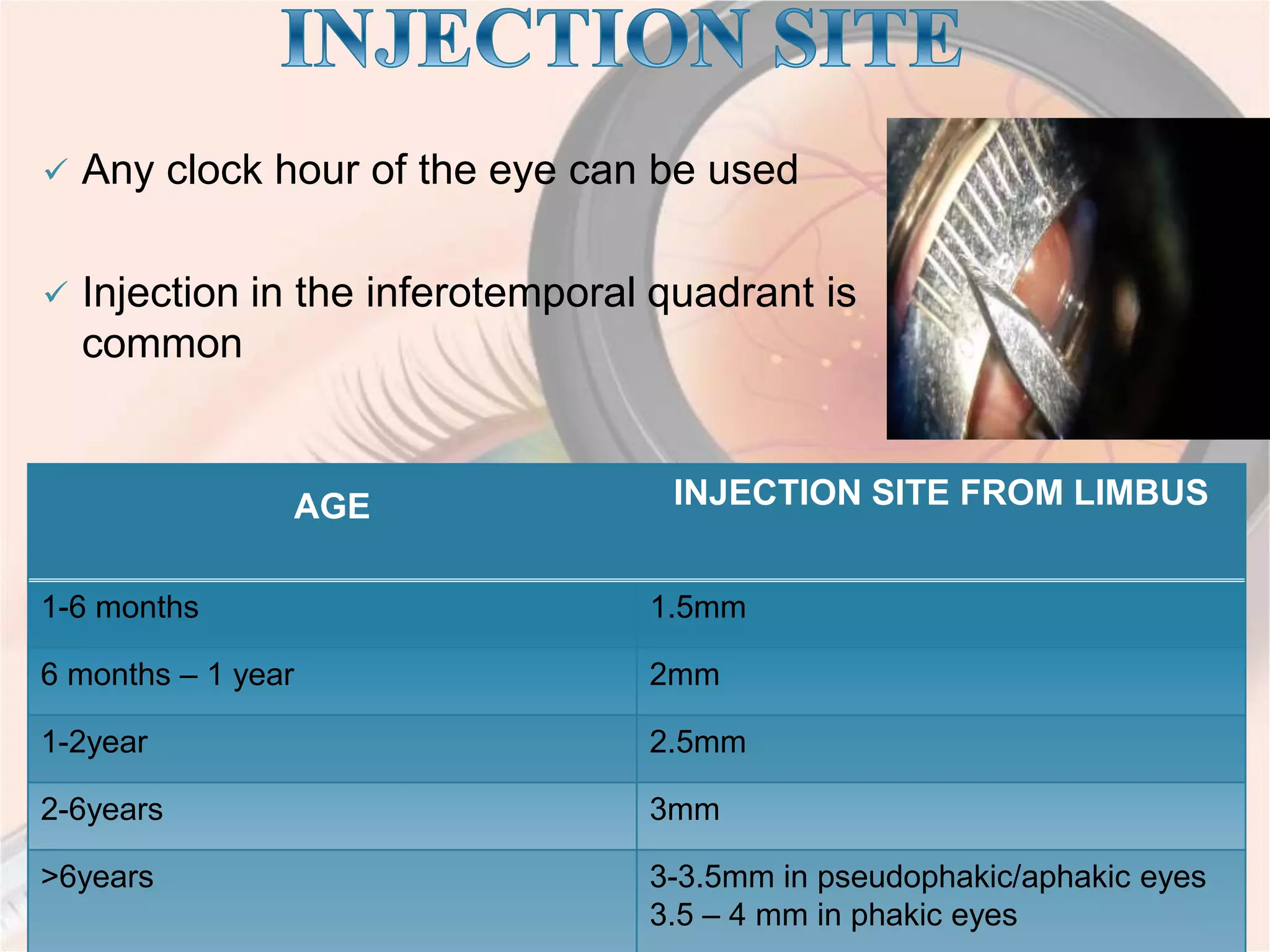 Intravitreal injection | PPTX | Eye and Vision Conditions | Diseases ...