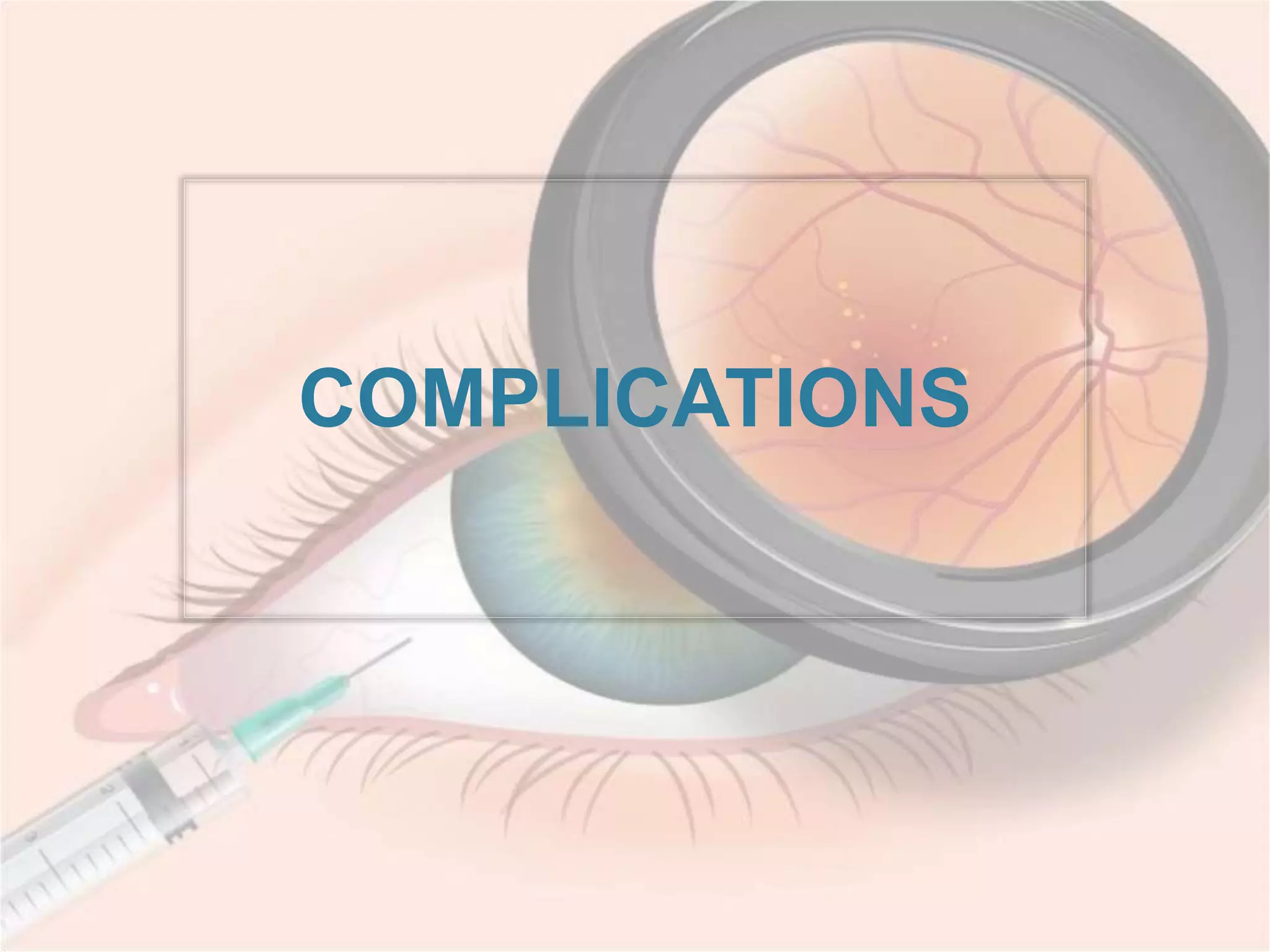 Intravitreal injection | PPTX