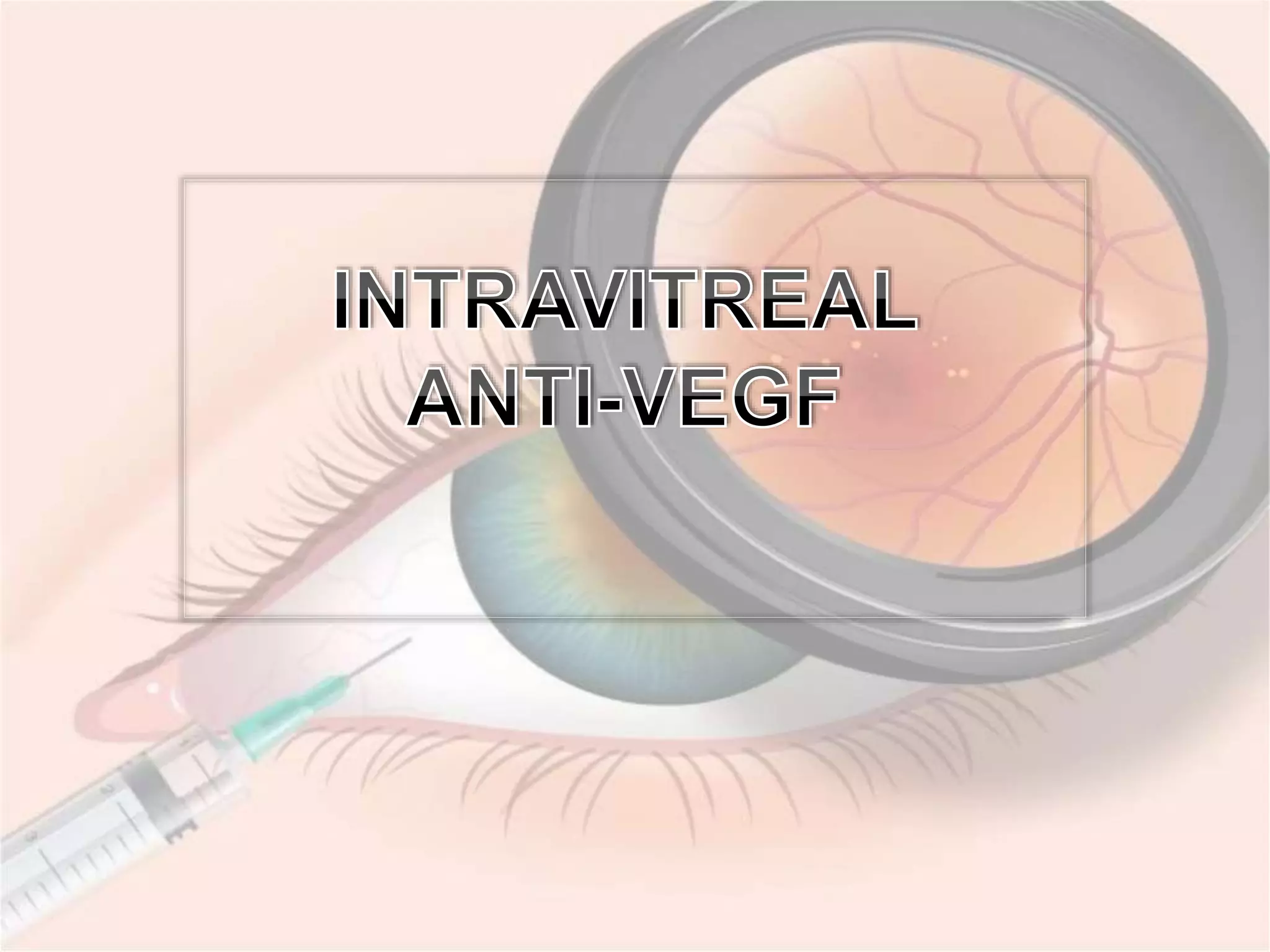 Intravitreal injection | PPTX | Eye and Vision Conditions | Diseases ...