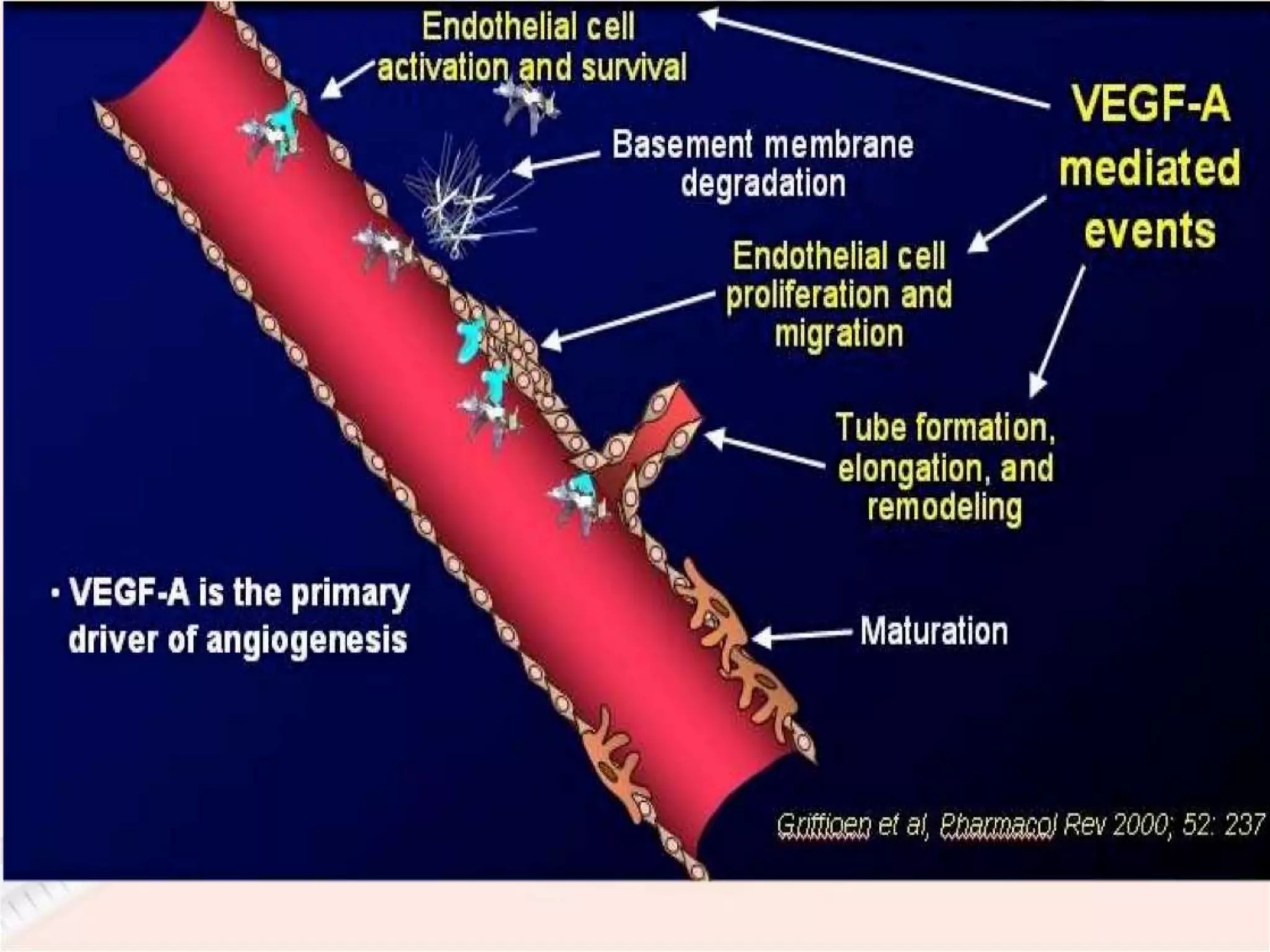 Intravitreal injection | PPTX