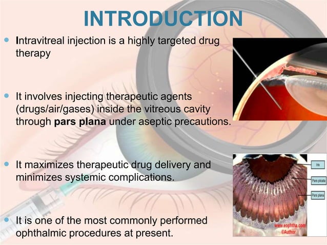 Intravitreal injection | PPT