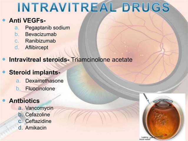 Intravitreal injection | PPTX | Eye and Vision Conditions | Diseases ...
