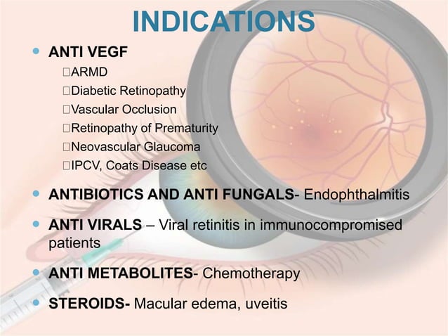Intravitreal injection | PPT