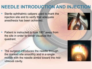Intravitreal Injection