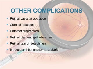 Intravitreal Injection