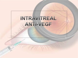 Avastin Intravitreal Injection