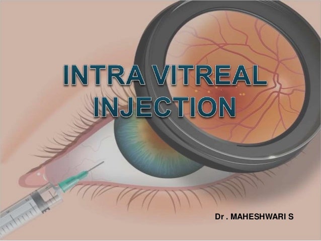 Intravitreal Injection