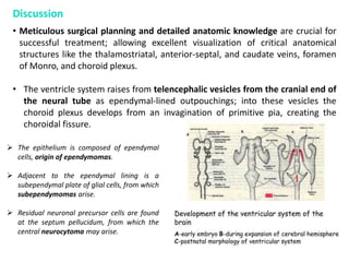 Intraventricular tumors.pptx