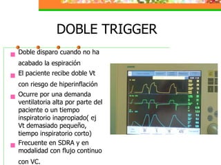 interpretacion de curvas del ventilador mecánico | PPT