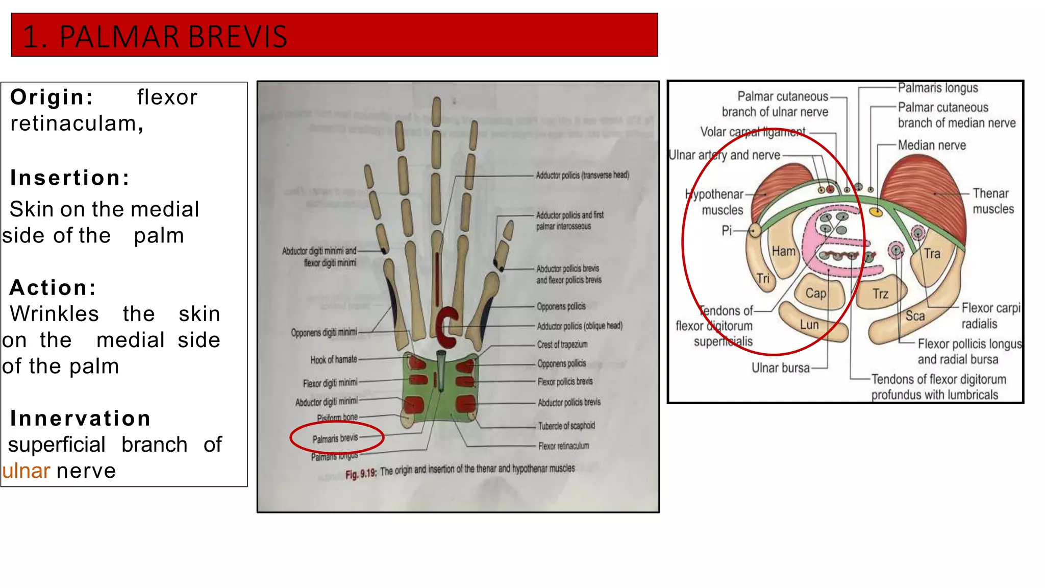 intrinsic muscles of Hand.pptx