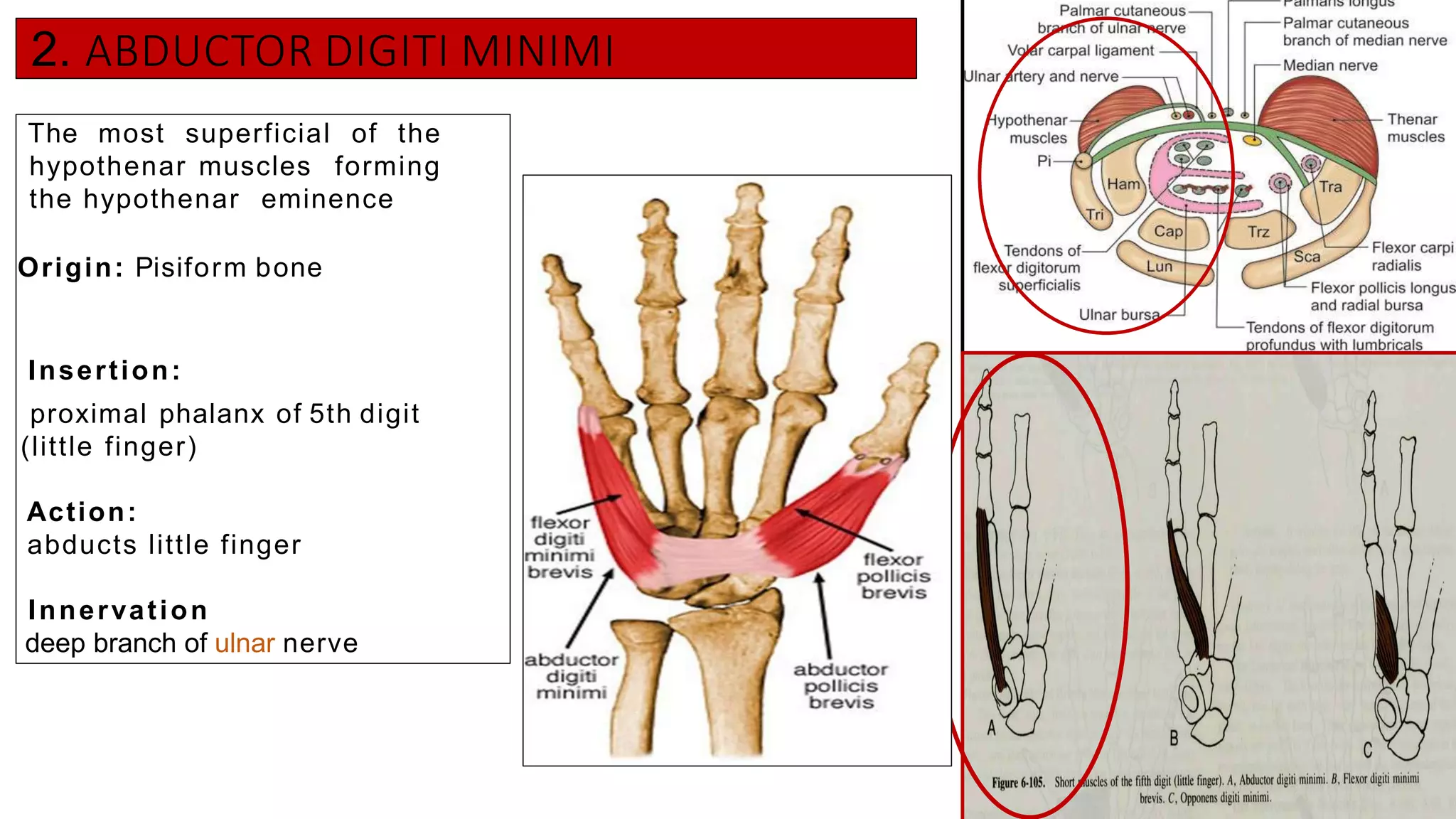 intrinsic muscles of Hand.pptx