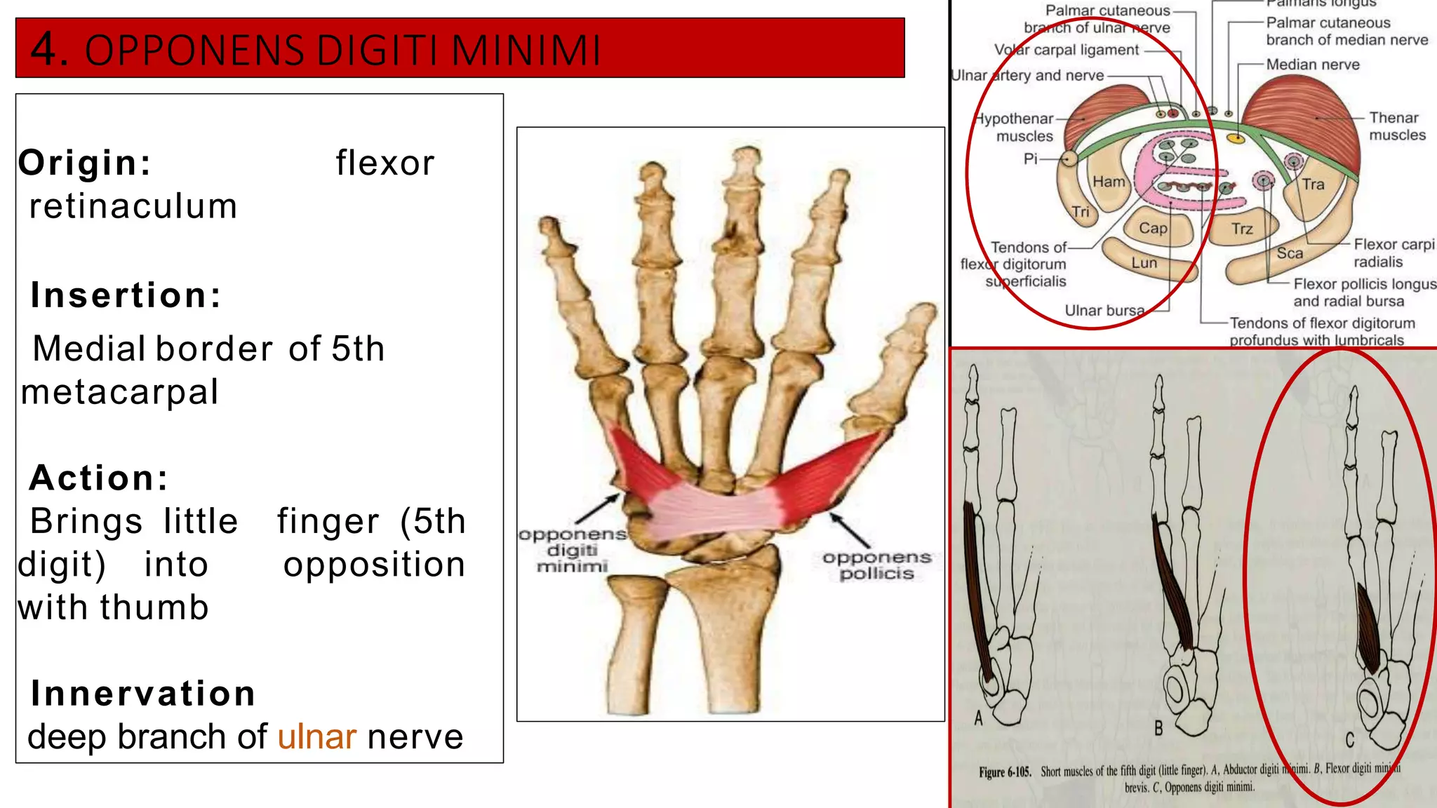 intrinsic muscles of Hand.pptx | Death, Injury, or Military Conflict ...