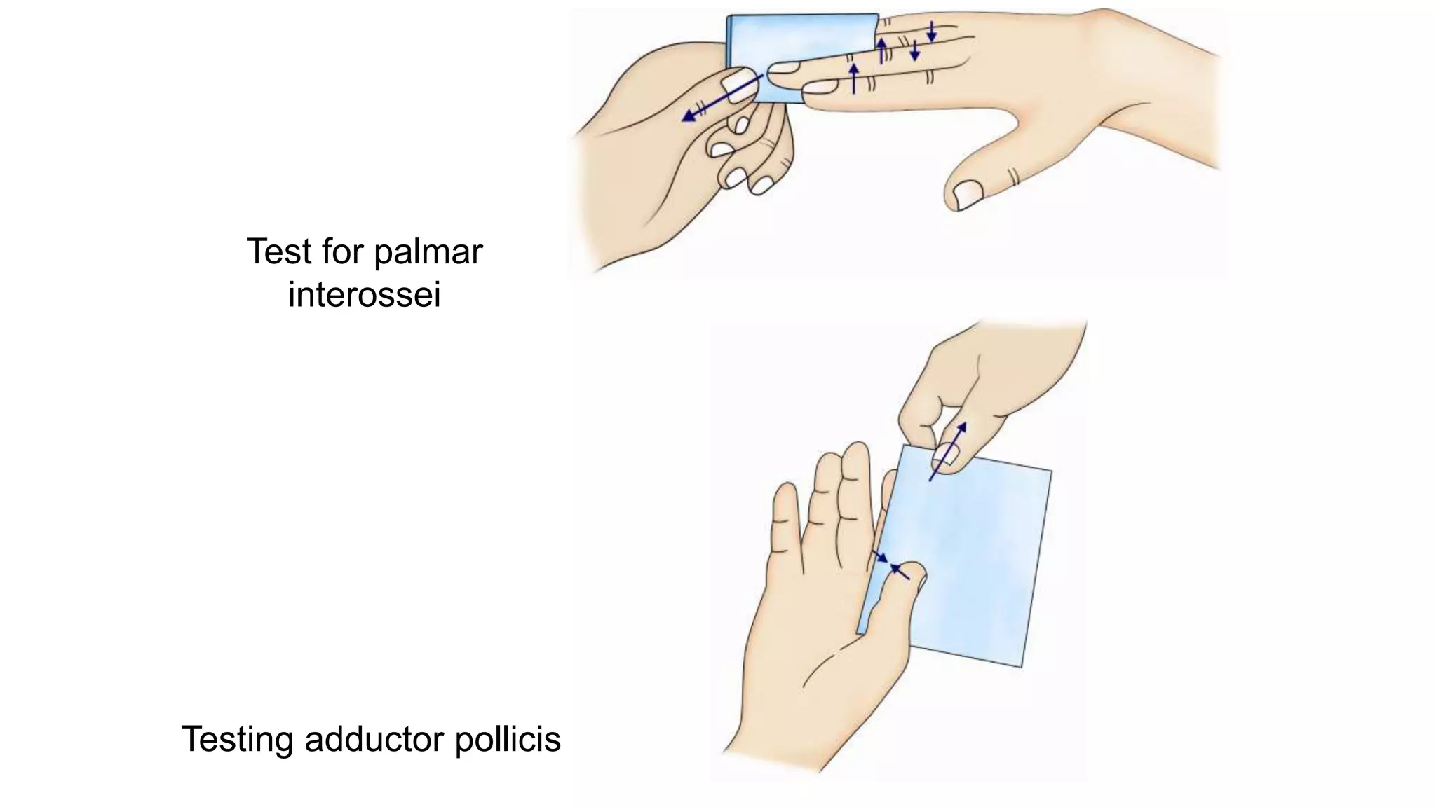 intrinsic muscles of Hand.pptx