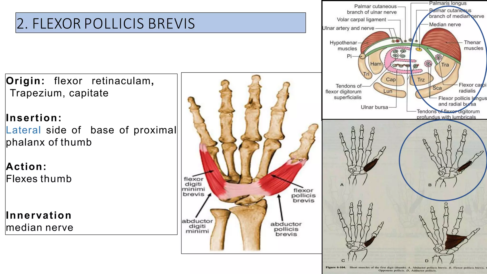 intrinsic muscles of Hand.pptx