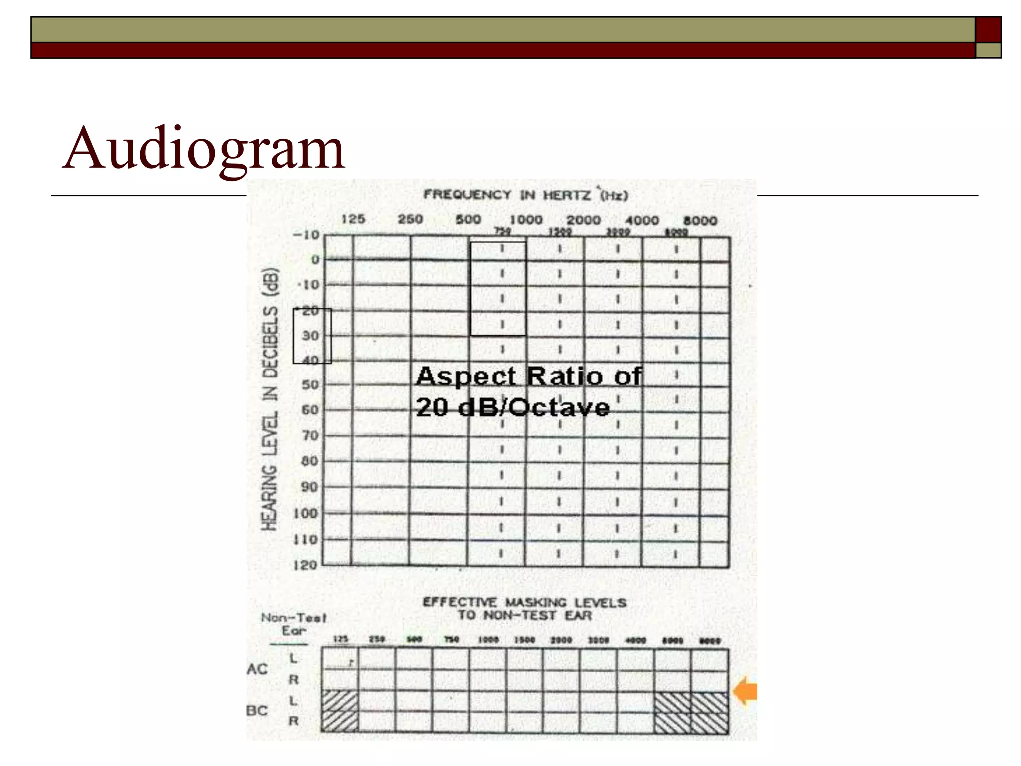 Introduction to Basic Audiology | PPT