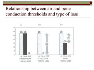 Introduction to Basic Audiology | PPT