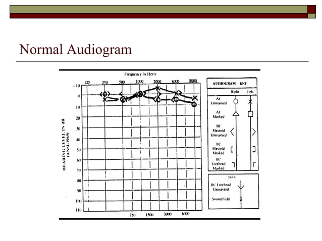 Introduction to Basic Audiology | PPT